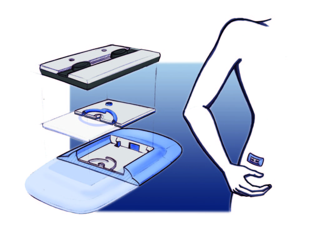 CRITICAL CONSIDERATIONS FOR HIGH VISCOSITY/HIGH VOLUME DEVICES ...